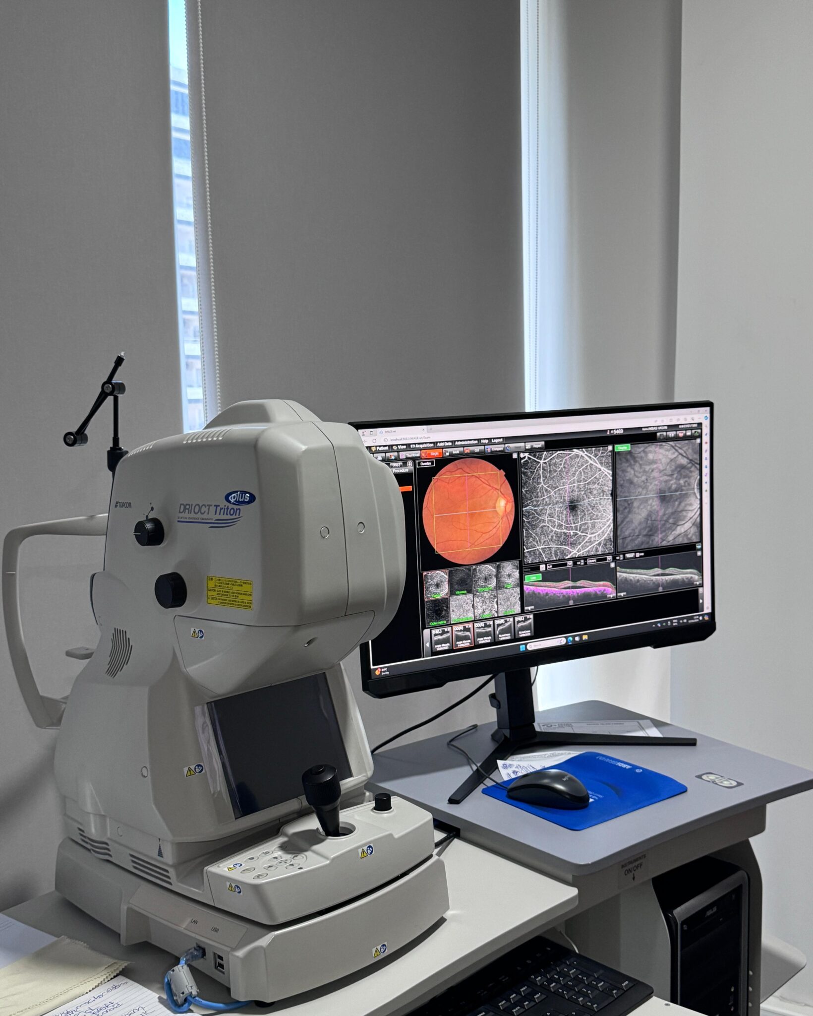 OCT ANJİO (OCTA) NEDİR? – Adana Retina