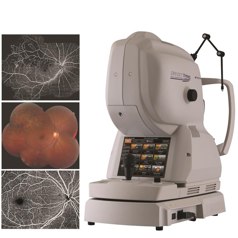 FUNDUS FLORESEİN ANJİOGRAFİ (FFA) – Adana Retina